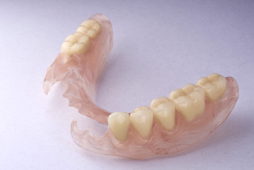 flexible-partial-dentures - South Calgary Denture and Implant Clinic